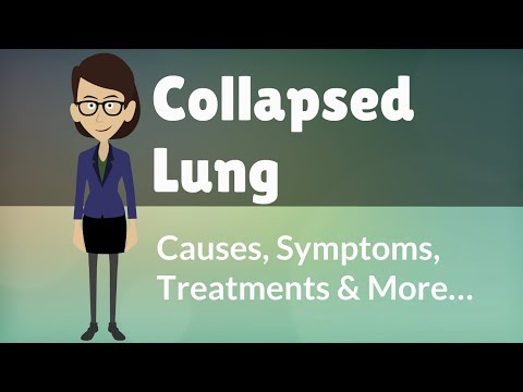 Collapsed Lung - Causes, Symptoms, Treatments & More…