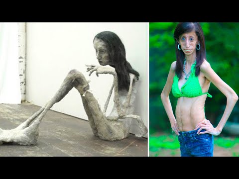 This Is the Thinnest Person In The World