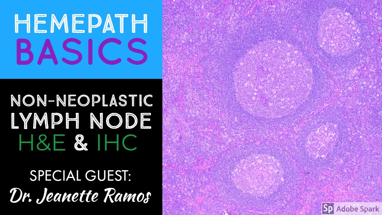 Hemepath Basics: Non-Neoplastic Lymph Node Histology & Immunostains with Dr. Jeanette Ramos