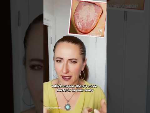 Tongue Diagnosis in TCM #chinesemedicine