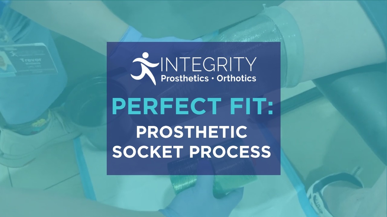 The Perfect Fit: Prosthetic Socket Process Explained
