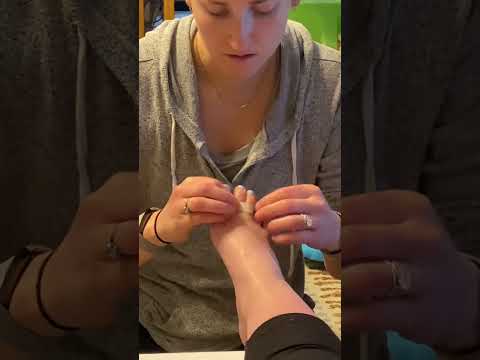 Toe buddy-taping