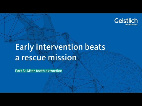 Early intervention beats a rescue mission