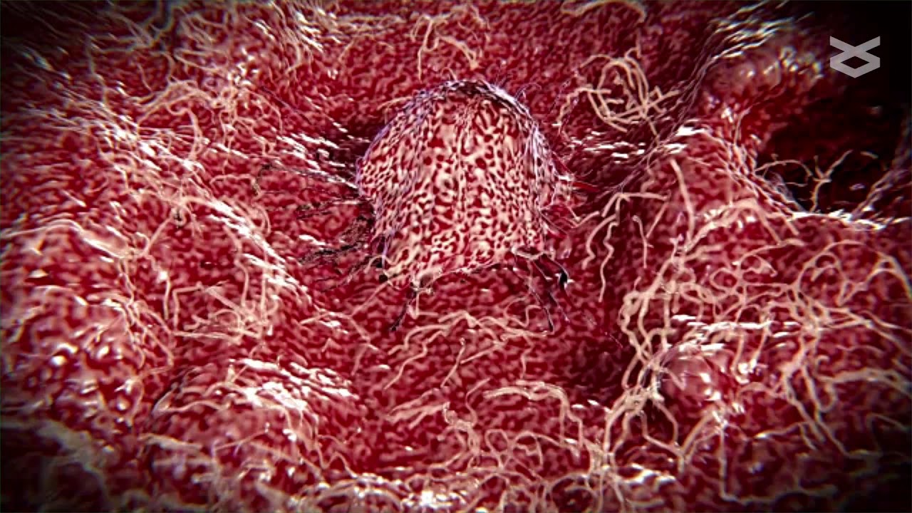 Computational model could help streamline angiogenesis based therapies