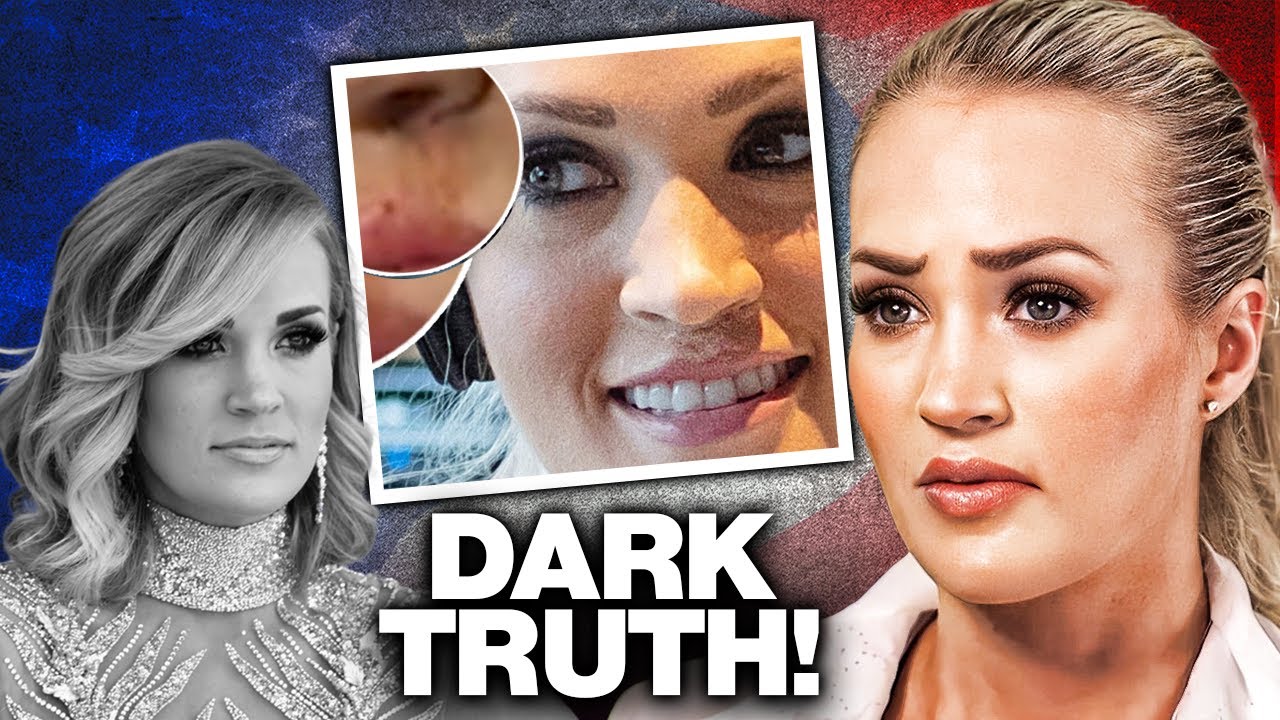 The Dark Truth About Carrie Underwood's Accident