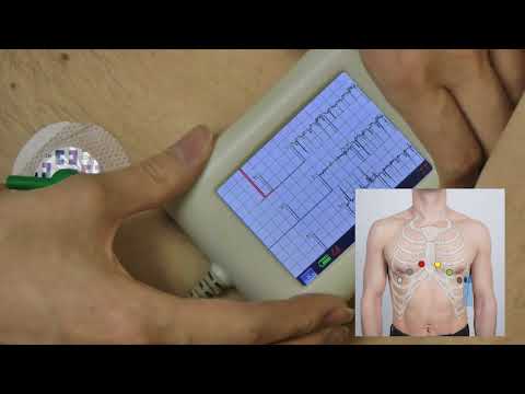 How to use the CardioMobile