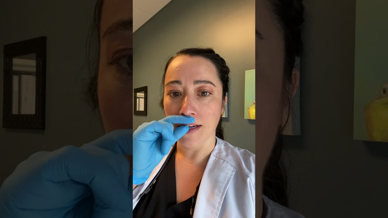 Frenectomy Lip post op exercises