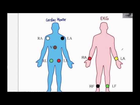 EKG 101 – Rush Emergency Medicine