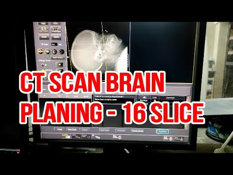 CAT scan Protocol, Positioning and Planning | Live Demo.