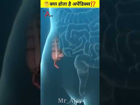क्या होता है अपेंडिक्स ?शरीर में इसकी ज़रूरत क्या है?#shorts