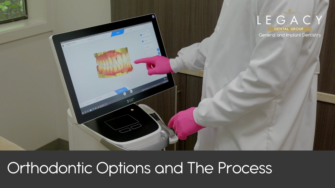Why Straight Teeth Matter More Than You Think!