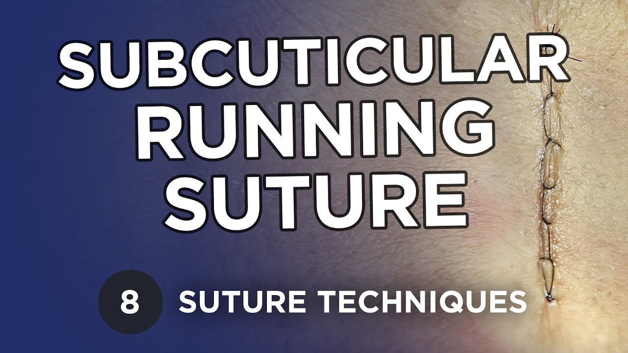 Subcuticular Running Suture - Learn Suture Techniques