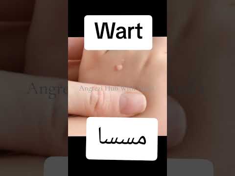Wart meaning in Urdu #wart