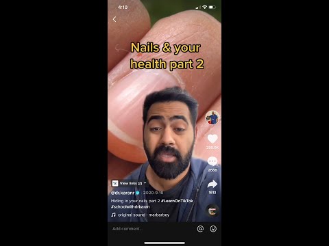 Doctor reacts to what your Nails say about your health! #shorts