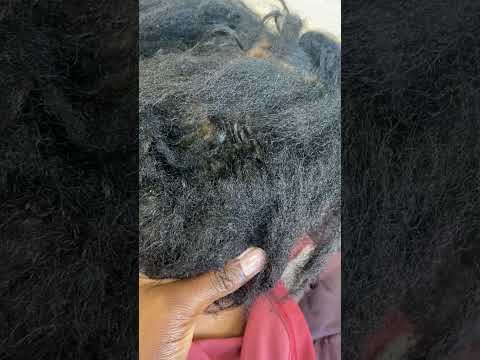 How to detangle Extremely matted hair on Afro hair🤭.