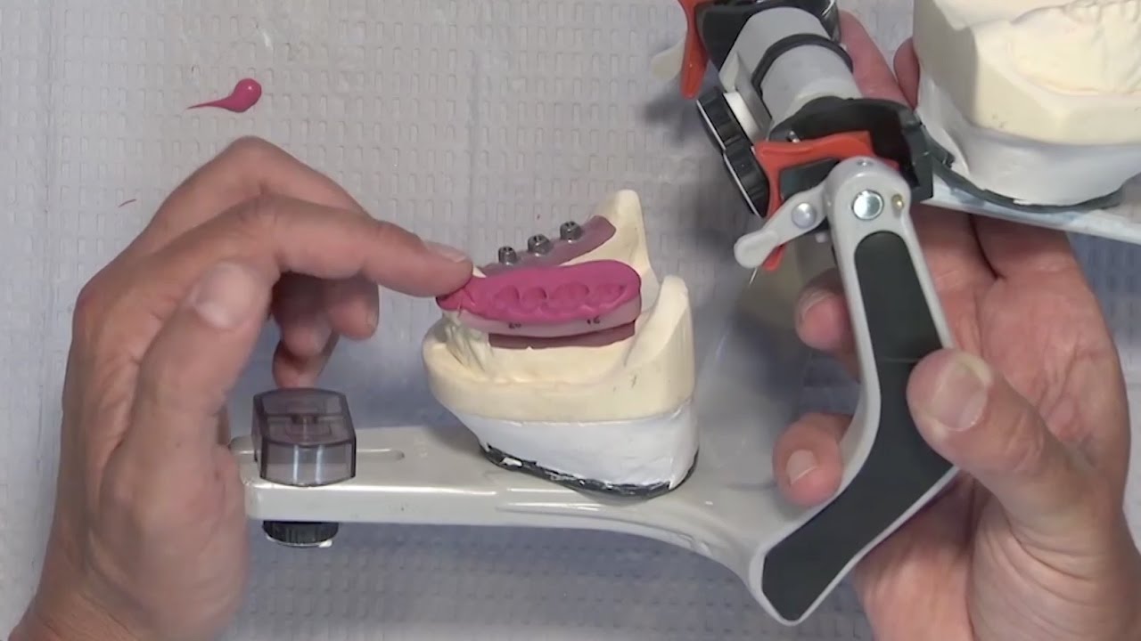 Case of the Week: Taking an Accurate Bite Registration