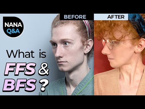 (Q&A) What are FFS and BFS? | All about Facial Feminization Surgery & Body Feminization Surgery FAQ