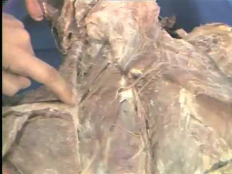 Gross Anatomy: Superficial and Deep Back Muscles