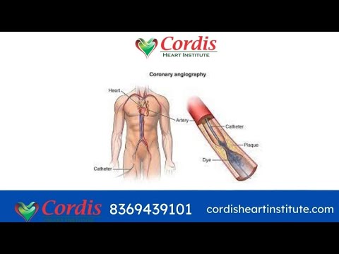 Coronary Angiography Test | Cardiologist Mira Road, Mumbai | Cardiology Test At Cordis Cath Lab
