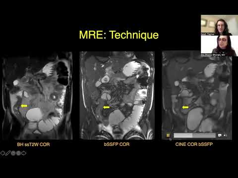 CT Versus MR Enterography: Point/Counterpoint