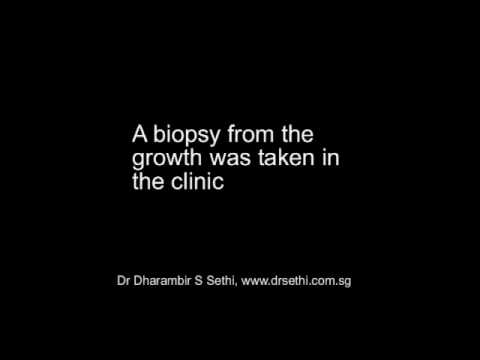 Diagnostic Nasal Endoscopy 03