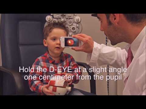 D-EYE Instructional Video