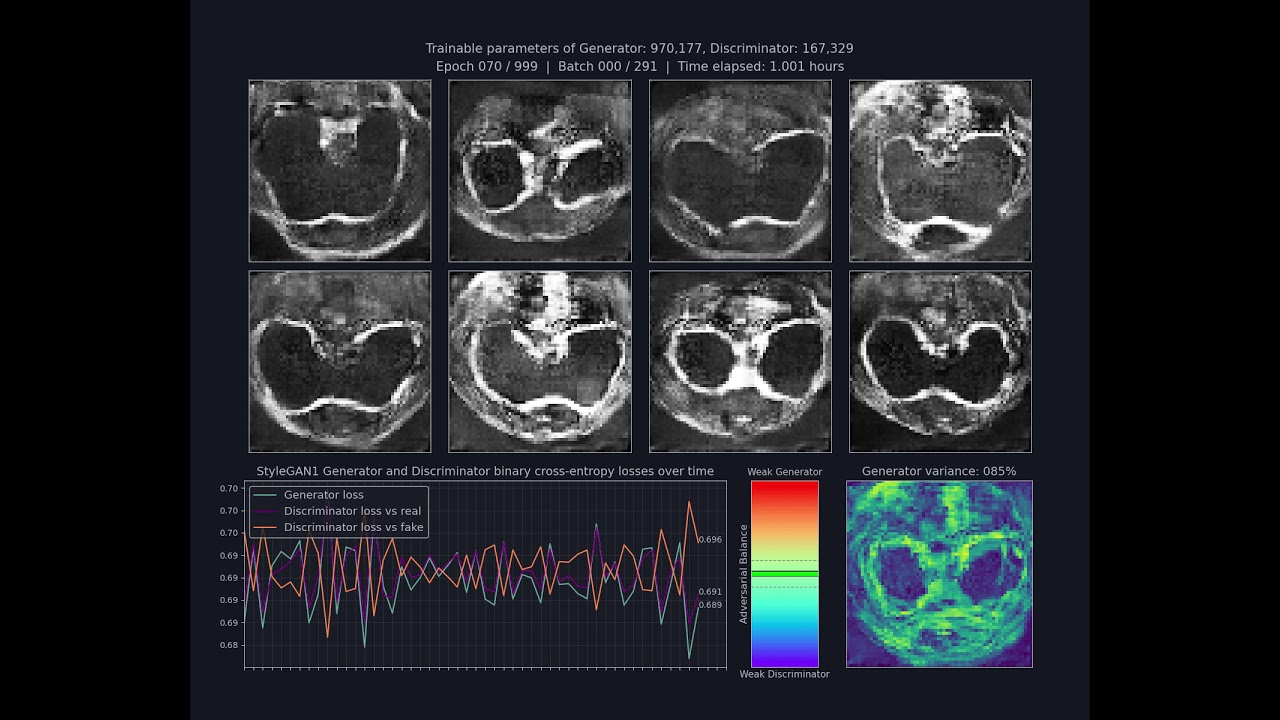 StyleGAN training on OAI AKOA Knee MRI dataset