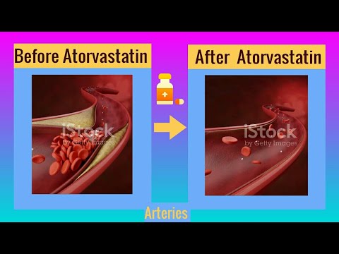 ATORVASTATIN Tablets For The Treatment of HIGH CHOLESTEROL