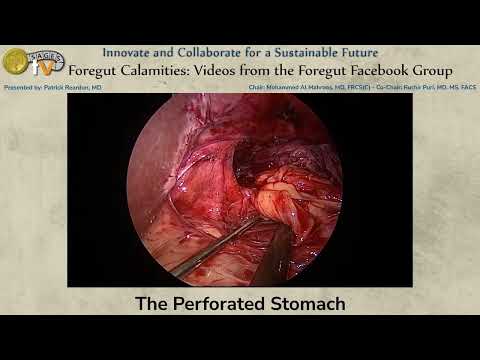 The Perforated Stomach