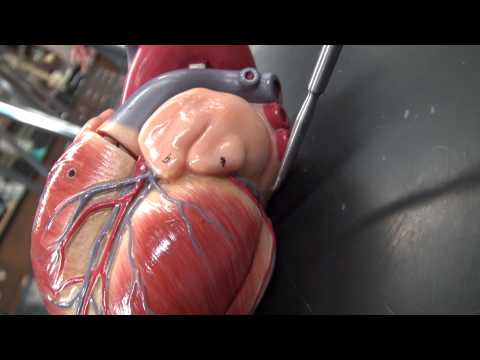 HEART ANATOMY QUIZ: ATRIOVENTRICULAR GROOVES.MTS