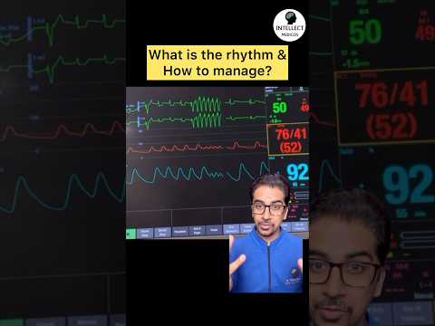 What is the rhythm & How yo manage? #cardiology #internalmedicine