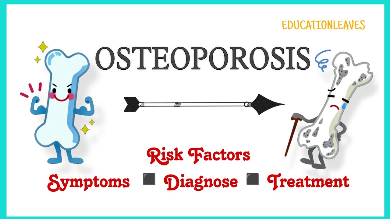 Osteoporosis: Risk Factors, Symptoms, Diagnose, & Treatment