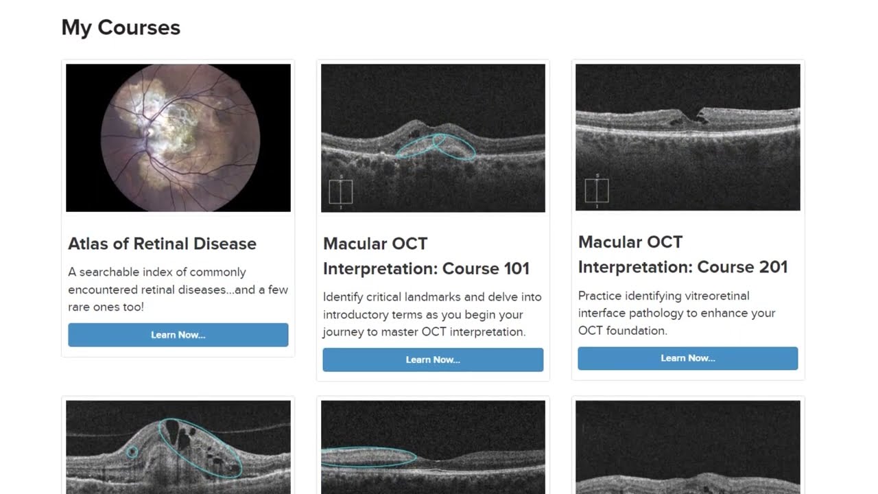 EyeCarePD Overview