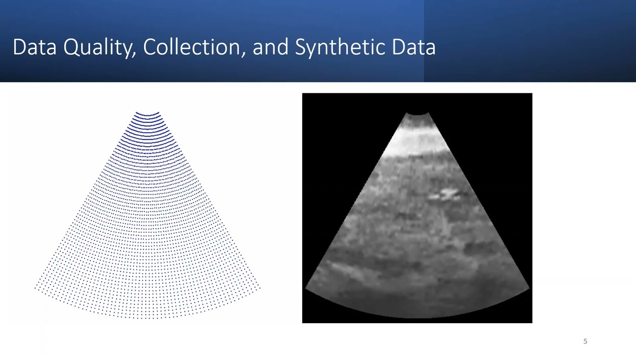 Improving Machine Learning Model Performance with a Data-Centric Approach