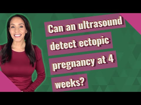 Can an ultrasound detect ectopic pregnancy at 4 weeks?