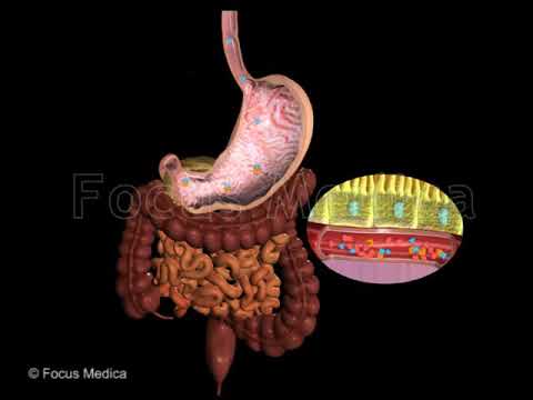 Pernicious Anemia - Animated Atlas of Breast and Gastric Cancer