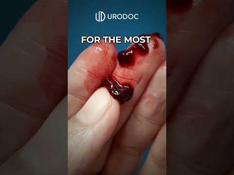 Do NOT use Vacuum Erection Devices until you've watched THIS!