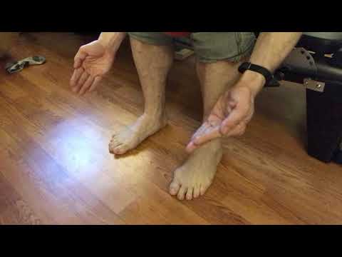 Working the “foot core” – My Sacroiliac Joint Saga