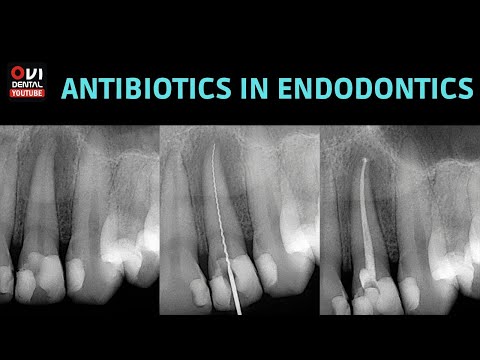 Antibiotics in Endodontics - a review / International Endodontic Journal / 2018