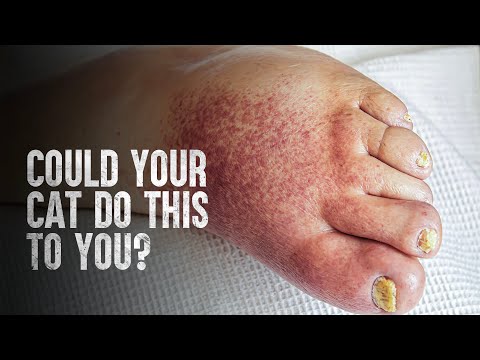 How to Survive Cat Scratch Fever