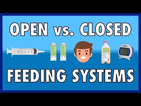 Open vs. Closed Feeding Systems
