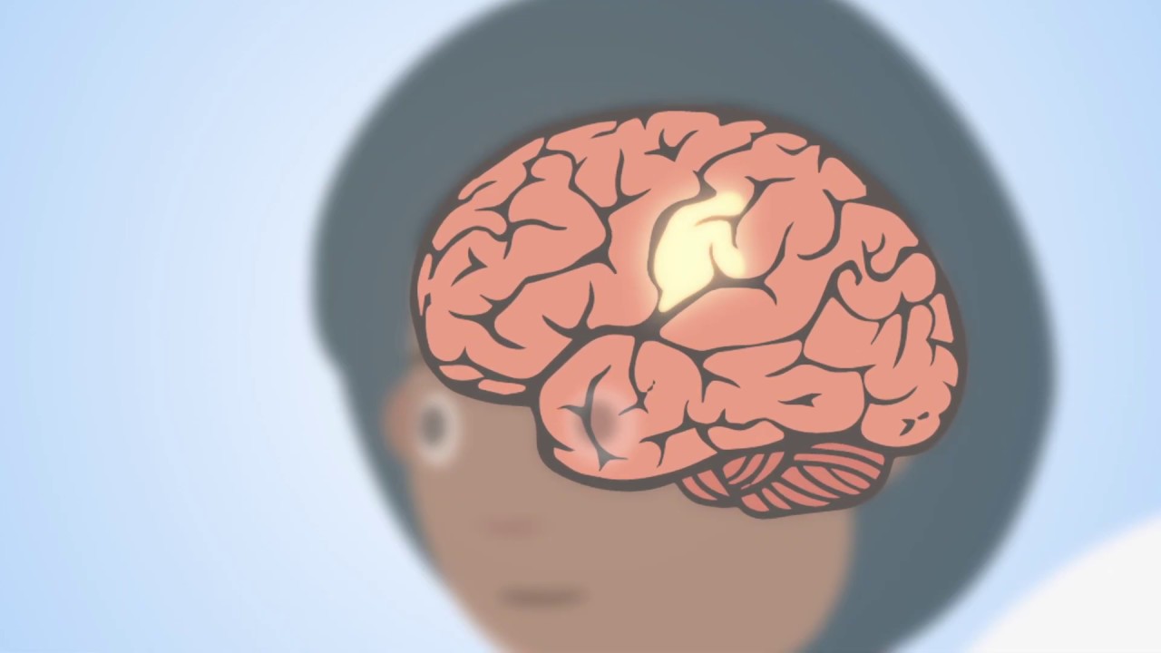 RST-SANEXAS: A revolutionary treatment for neuropathy and other ...