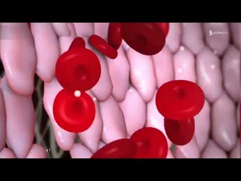 Thoracic Aortic Disease