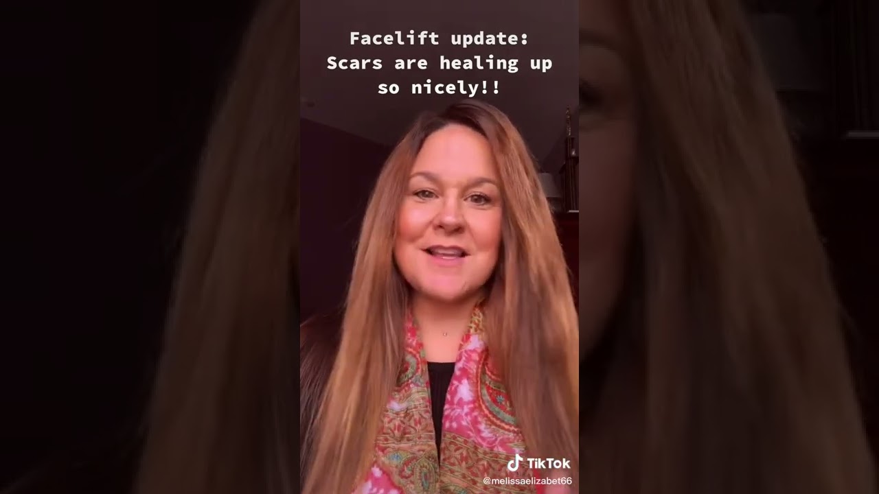 Facelift Scars Behind Ears: 