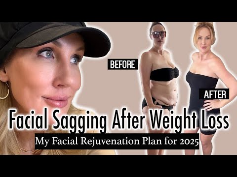 Weight Loss & Facial Sagging - My 2025 Facial Rejuvenation Plan
