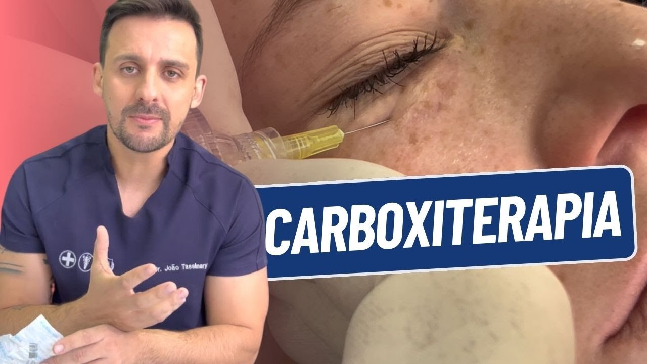 COMO APLICAR CARBOXITERAPIA | DR. JOÃO TASSINARY