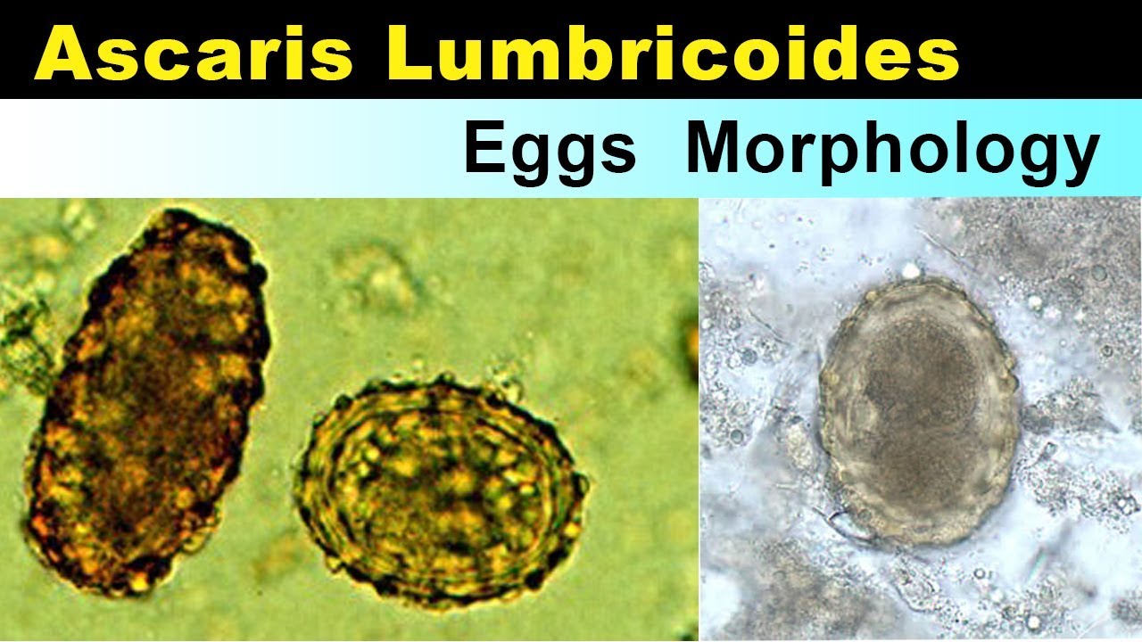 Ascaris lumbricoides  eggs Morphology