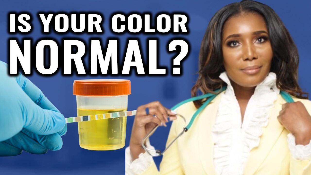 What Your Urine Color Says About Your Health - Kidney Doctor Explains Color Chart #healthtips