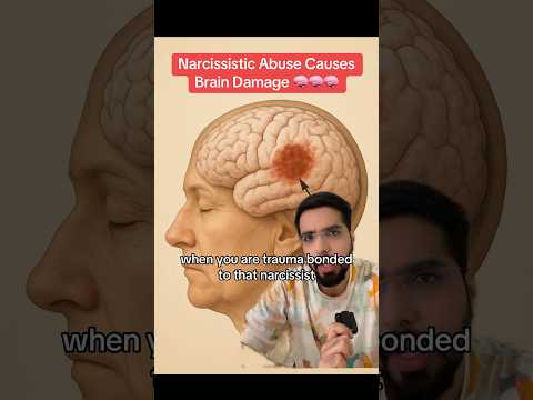 How a Trauma Bond with a Narcissist Rewires and Damages Your Brain