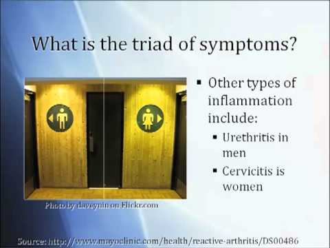 Reactive Arthritis versus Reiter's Syndrome